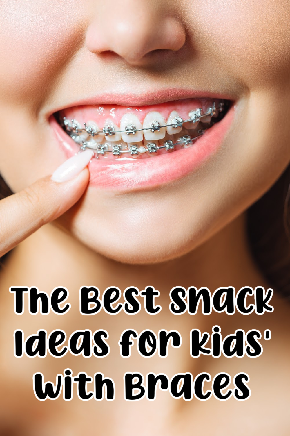 The Best Snack Ideas For Kids With Braces